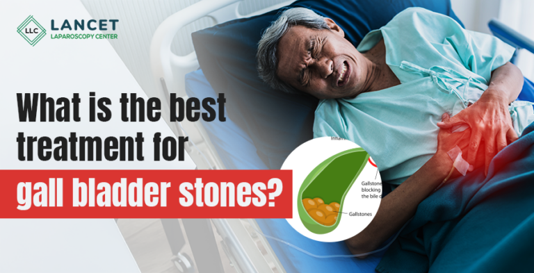 Best Treatment for Gall Bladder Stones Removal | Dr Ramesh @ Lancet